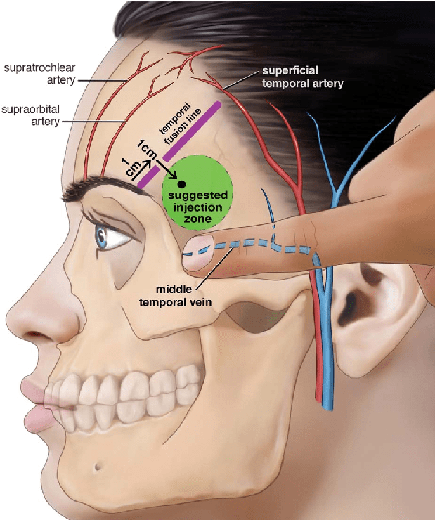 Unit 4: Temple Anatomy and Revolumisation - Doctor Wellness